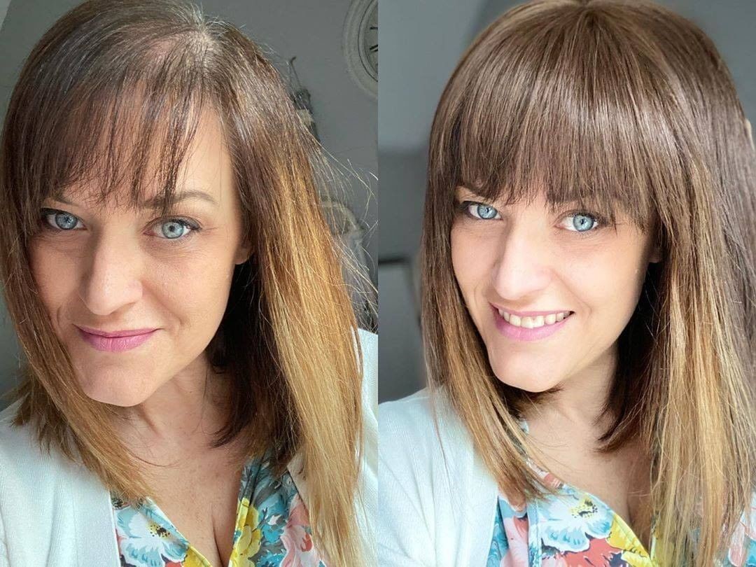 UNIWIGS HAIR TOPPER BEFORE & AFTER – Hair Topper Trends